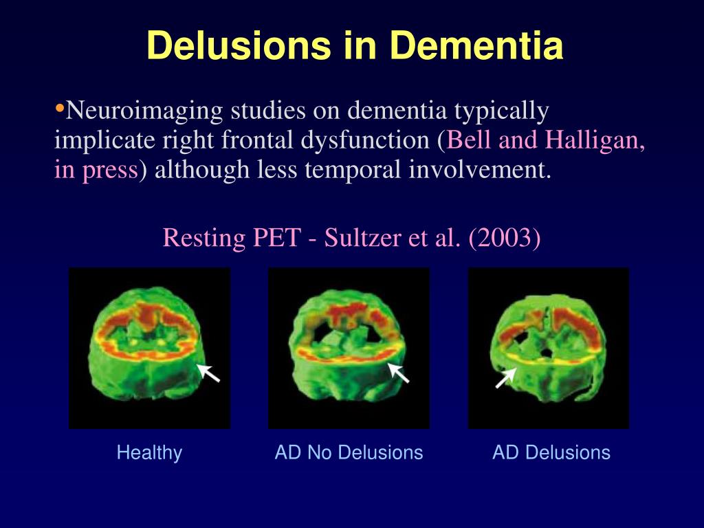 PPT - Neuropsychology of Delusions in Schizophrenia and ...