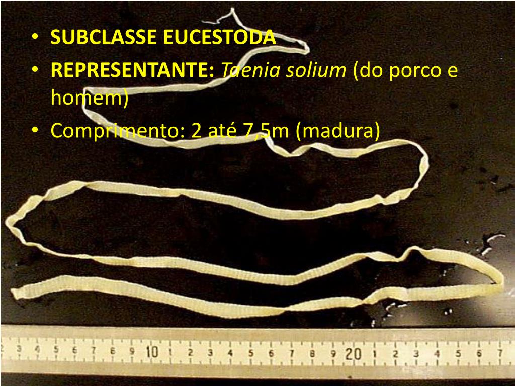 PPT - Filo Platyhelminthes Classe Cestoda ( CESTUS = CINTA ; OID ...