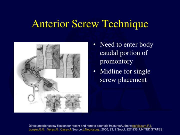 PPT - Upper Cervical Spine Fractures PowerPoint Presentation - ID:1733260