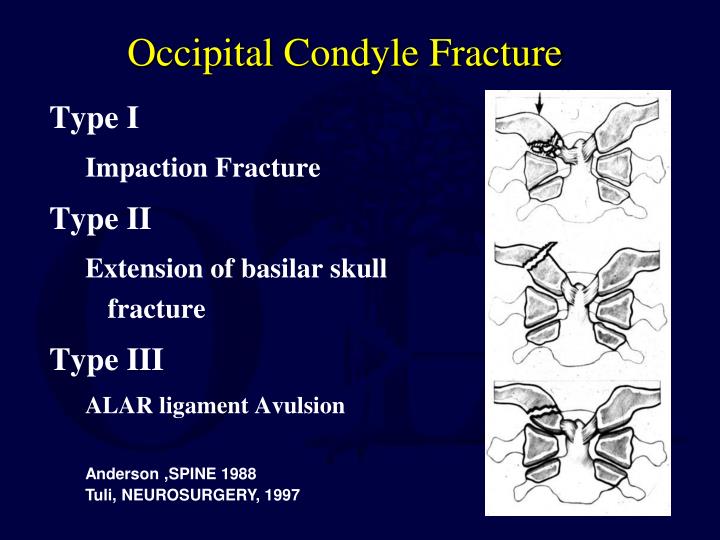 PPT - Upper Cervical Spine Fractures PowerPoint Presentation - ID:1733260