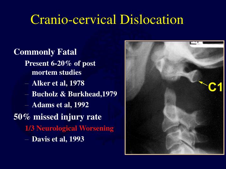 PPT - Upper Cervical Spine Fractures PowerPoint Presentation - ID:1733260
