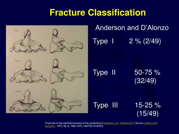 PPT - Upper Cervical Spine Fractures PowerPoint Presentation - ID:1733260