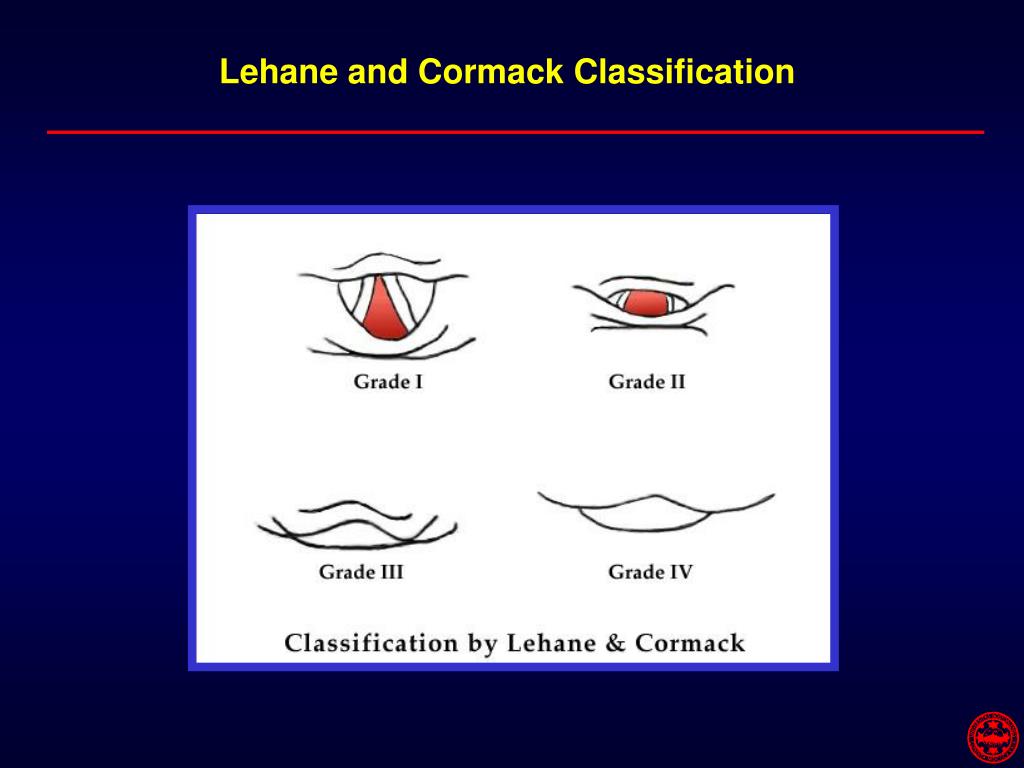 PPT - The Difficult Airway Rafael Ortega, M.D. Associate Professor of ...