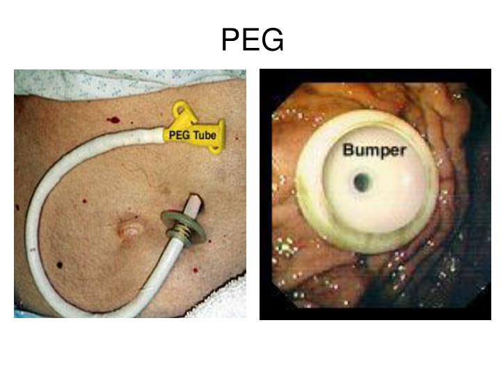 PPT - Endoscopia digestiva PowerPoint Presentation - ID:1737167