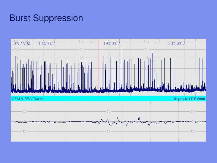 PPT - Cerebral Function Monitoring Amplitude-Integrated EEG – aEEG ...