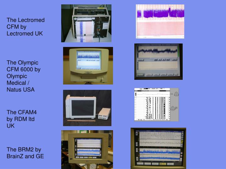 Brainz Monitor Electrode Placement at Maria Kring blog