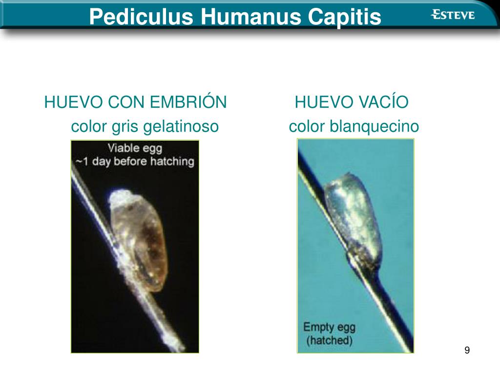 PPT - INFORMACIÓN Y CONSEJOS ACERCA DE LAS PEDICULOSIS PowerPoint ...