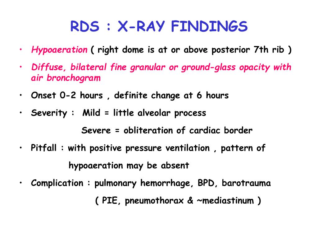 PPT - Pediatric Radiology for R a ngsit medical students PowerPoint ...