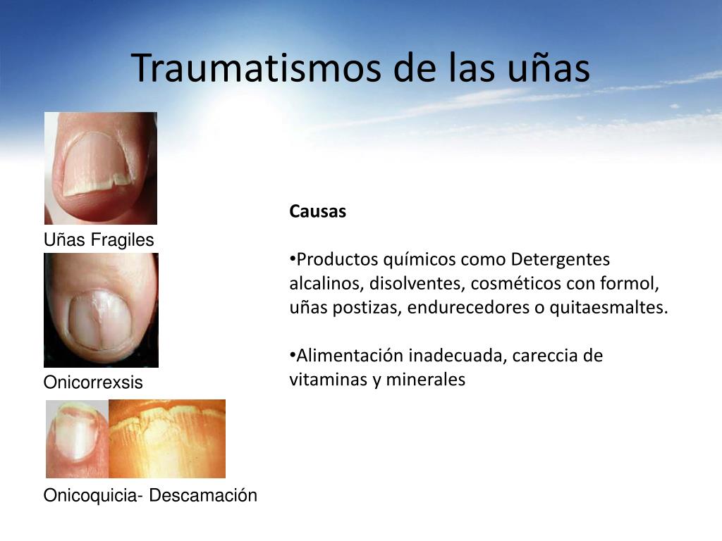 PPT - Hair&Nail NutriComplex: PowerPoint Presentation, free download ...