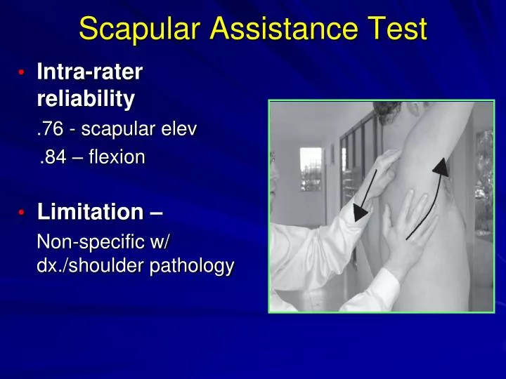 PPT - Scapular Assistance Test PowerPoint Presentation, free download ...
