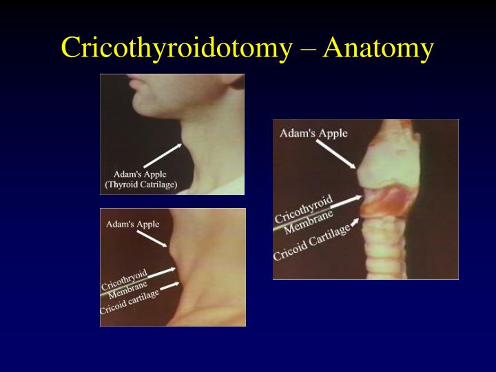 PPT - Surgical Procedures PowerPoint Presentation - ID:1743187