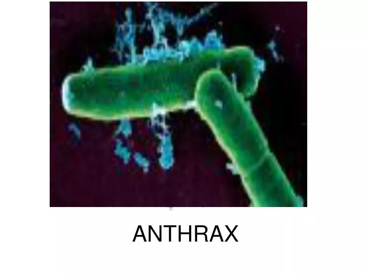 PPT - ANTHRAX PowerPoint Presentation, free download - ID:1743433