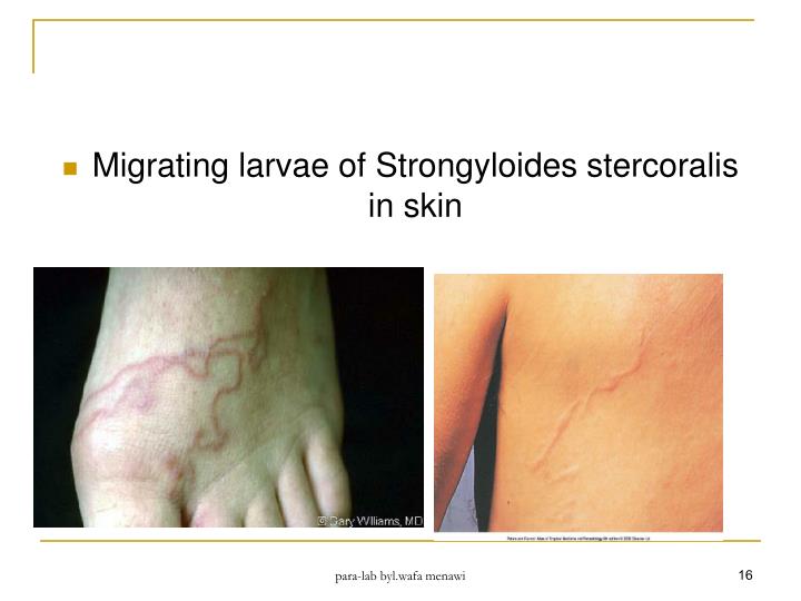 PPT - Strongyloides Stercoralis PowerPoint Presentation - ID:1743787
