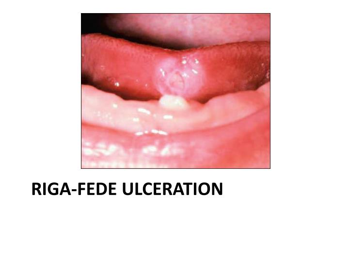PPT - March 4, 2011 PowerPoint Presentation - ID:1744064