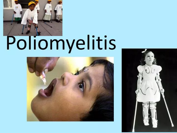PPT - Poliomyelitis PowerPoint Presentation, free download - ID:1745727