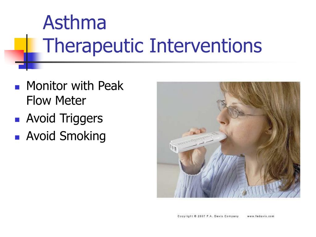 PPT - Timby/Smith: Introductory Medical-Surgical Nursing, 10/e ...