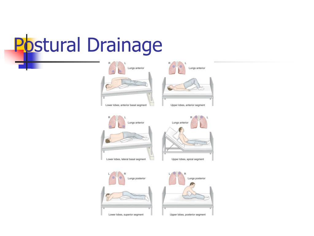 PPT - Timby/Smith: Introductory Medical-Surgical Nursing, 10/e ...