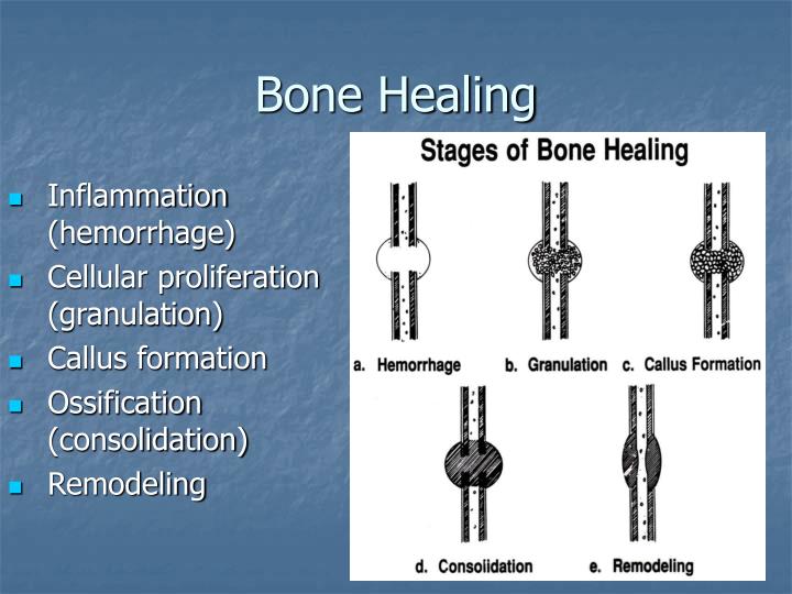 PPT - Orthopedic Surgery PowerPoint Presentation - ID:1747320
