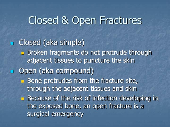 PPT - Orthopedic Surgery PowerPoint Presentation - ID:1747320