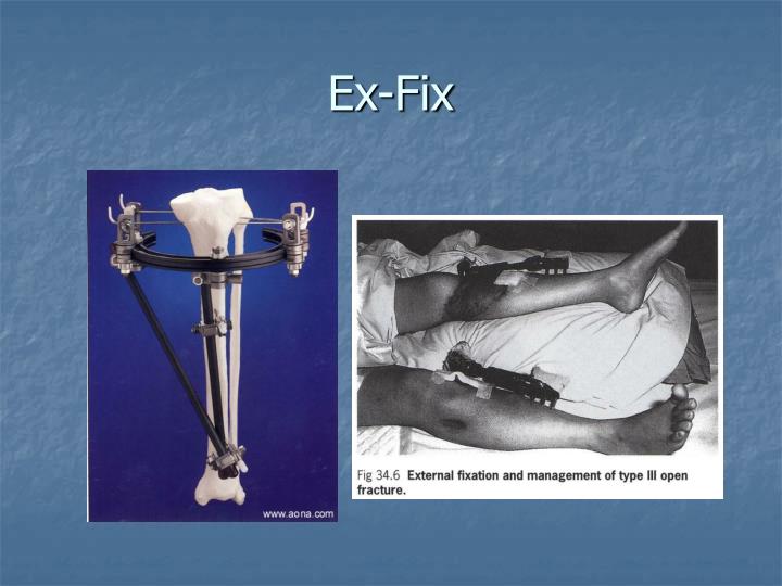 PPT - Orthopedic Surgery PowerPoint Presentation - ID:1747320