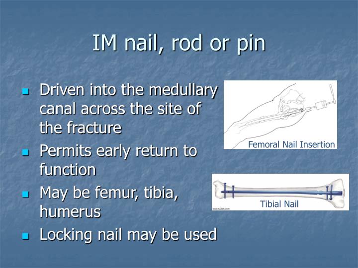 PPT - Orthopedic Surgery PowerPoint Presentation - ID:1747320
