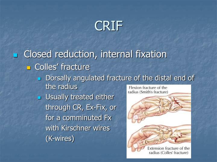 PPT - Orthopedic Surgery PowerPoint Presentation - ID:1747320