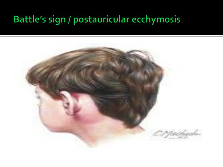PPT - Trauma PowerPoint Presentation - ID:1748939