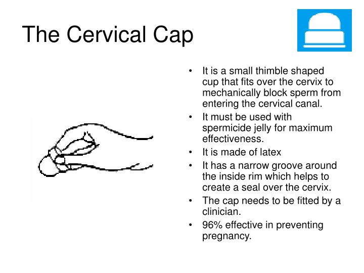 PPT - Contraceptive Methods PowerPoint Presentation - ID:1749316