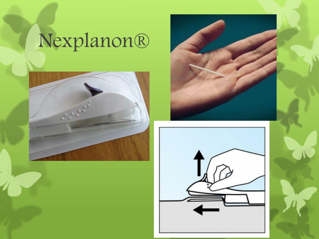 PPT - Teens and Contraception : New Approaches for Improved Compliance ...