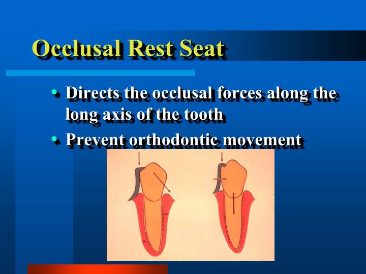 PPT - Minor Connectors & Rests PowerPoint Presentation - ID:1751363