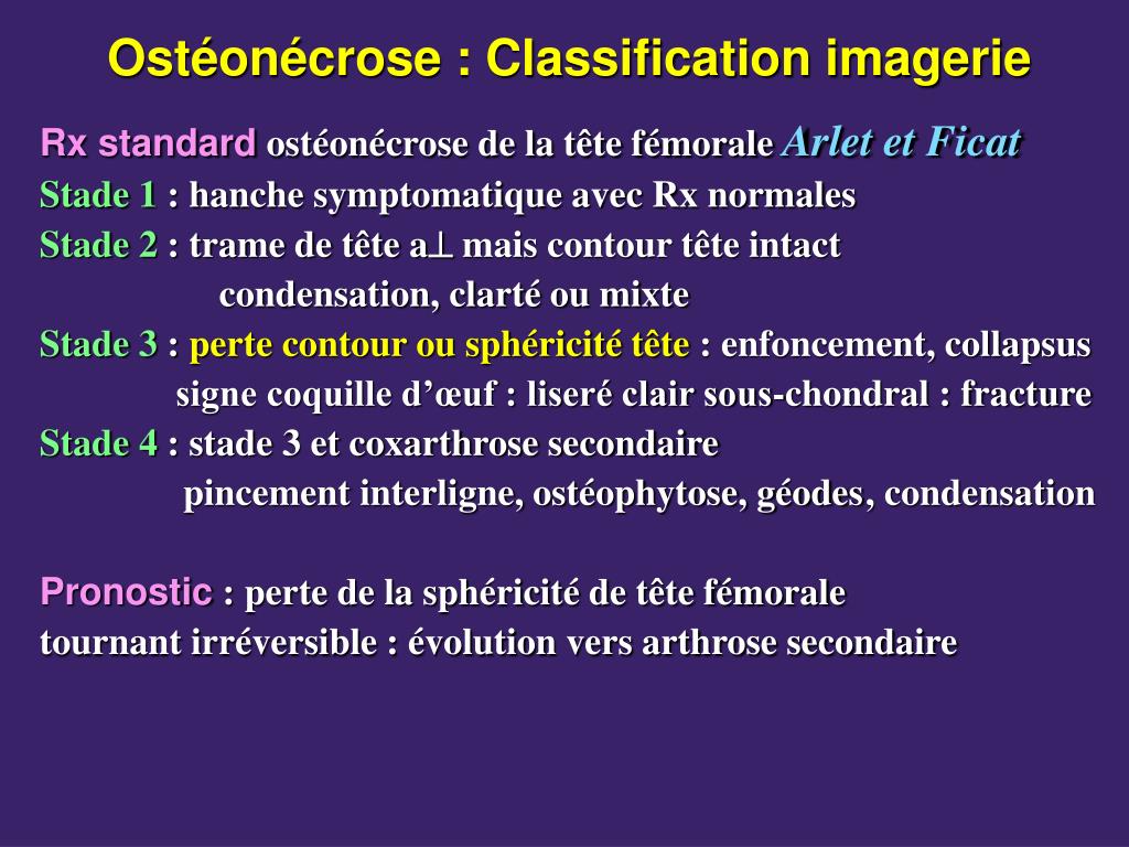 PPT - Ostéonécrose : Définition PowerPoint Presentation, free download ...