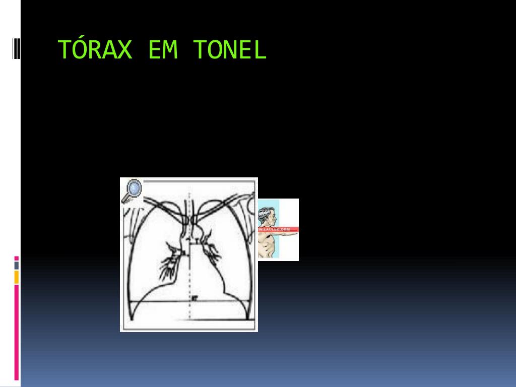 PPT - SEMIOLOGIA RESPIRATÓRIA PowerPoint Presentation, free download ...