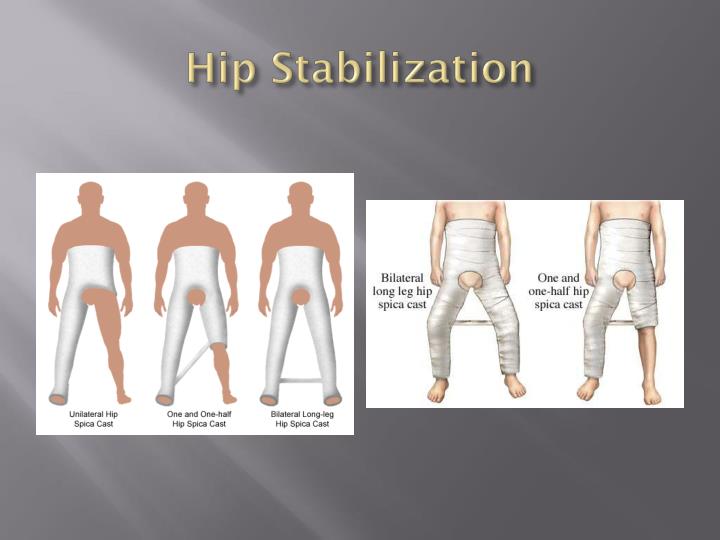 PPT - Orthopedic Surgery PowerPoint Presentation - ID:1759516