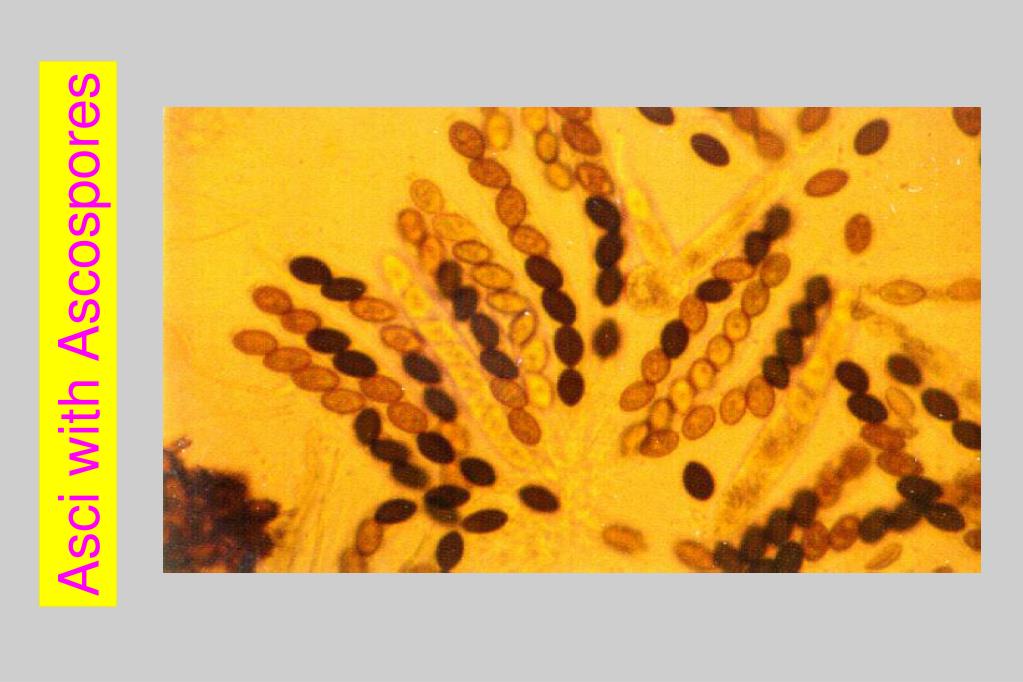 PPT - Fungal Life Cycles Prof. Khaled H. Abu-Elteen PowerPoint ...