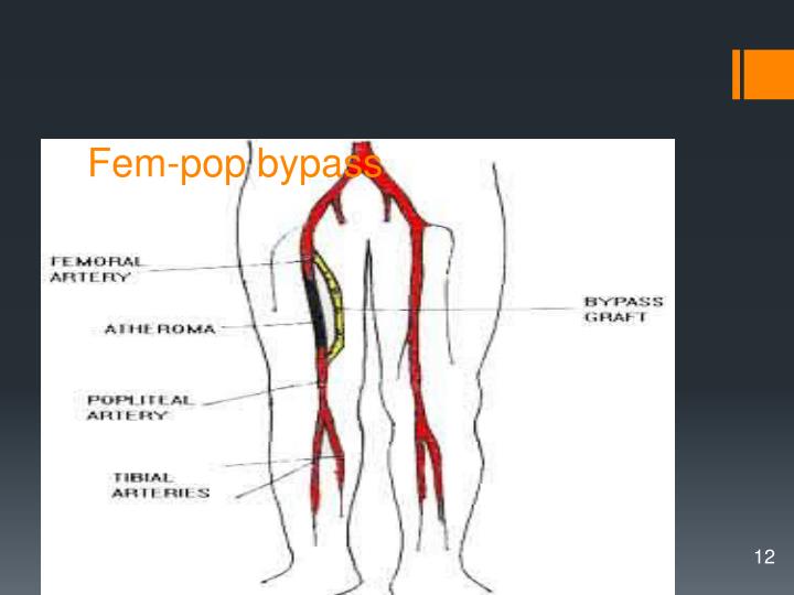 PPT - Vascular PowerPoint Presentation - ID:1761434