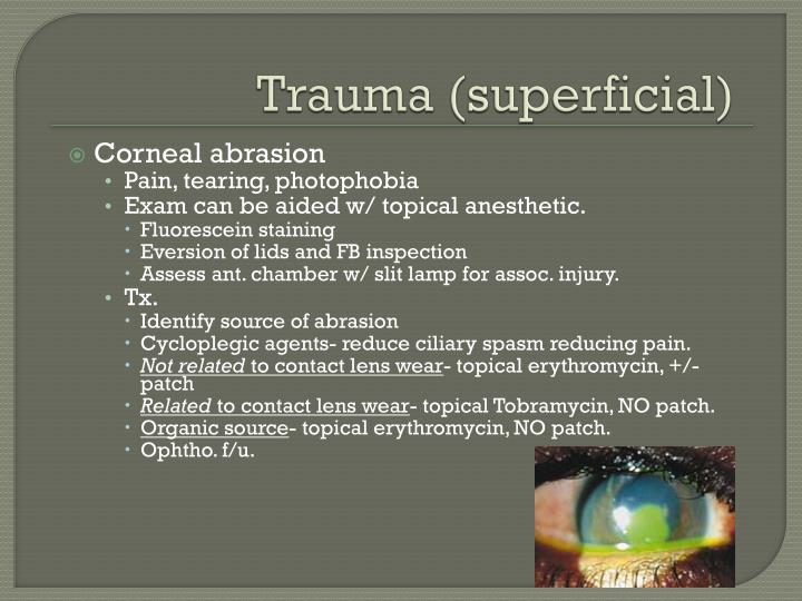 PPT - Ocular emergencies PowerPoint Presentation - ID:1761449
