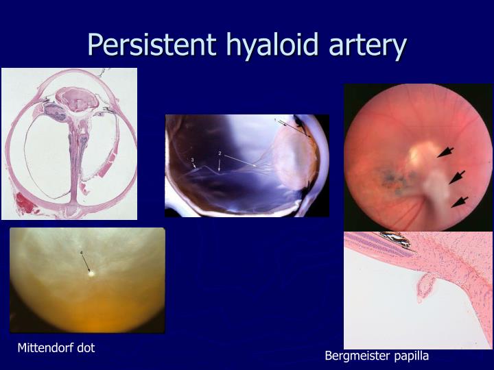 Ppt Pediatric Optometry Powerpoint Presentation Id1761791