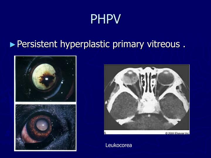 PPT - Pediatric Optometry PowerPoint Presentation - ID:1761791