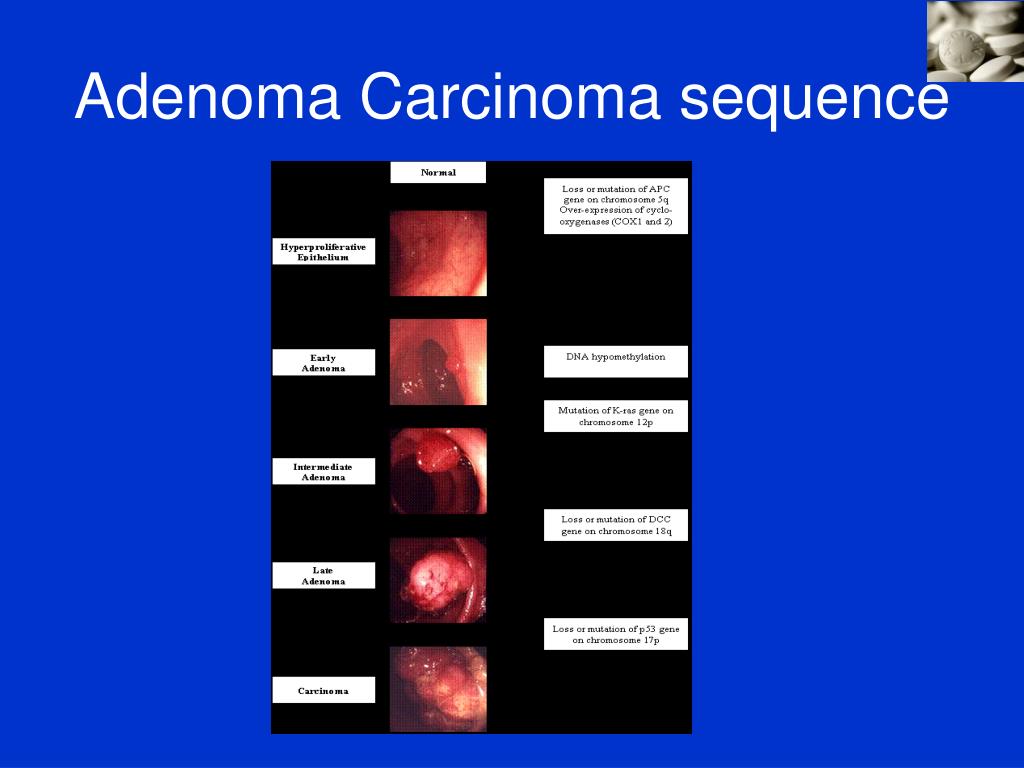 PPT - Chemoprevention of Colorectal Cancer 2011 PowerPoint Presentation ...