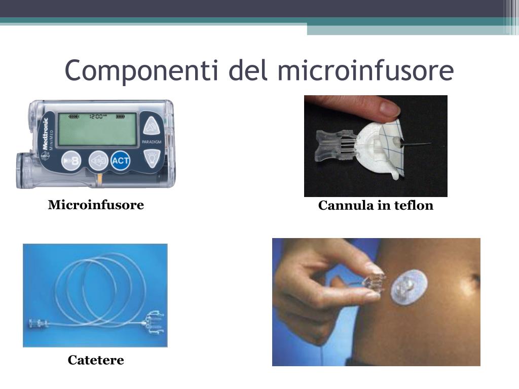 PPT - Il Microinfusore di insulina nella terapia del Diabete Mellito ...