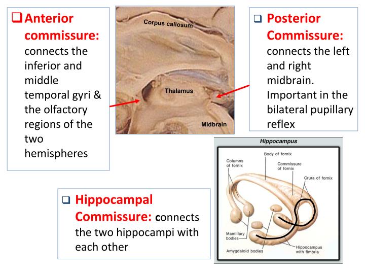 PPT - CEREBRUM PowerPoint Presentation - ID:1770207