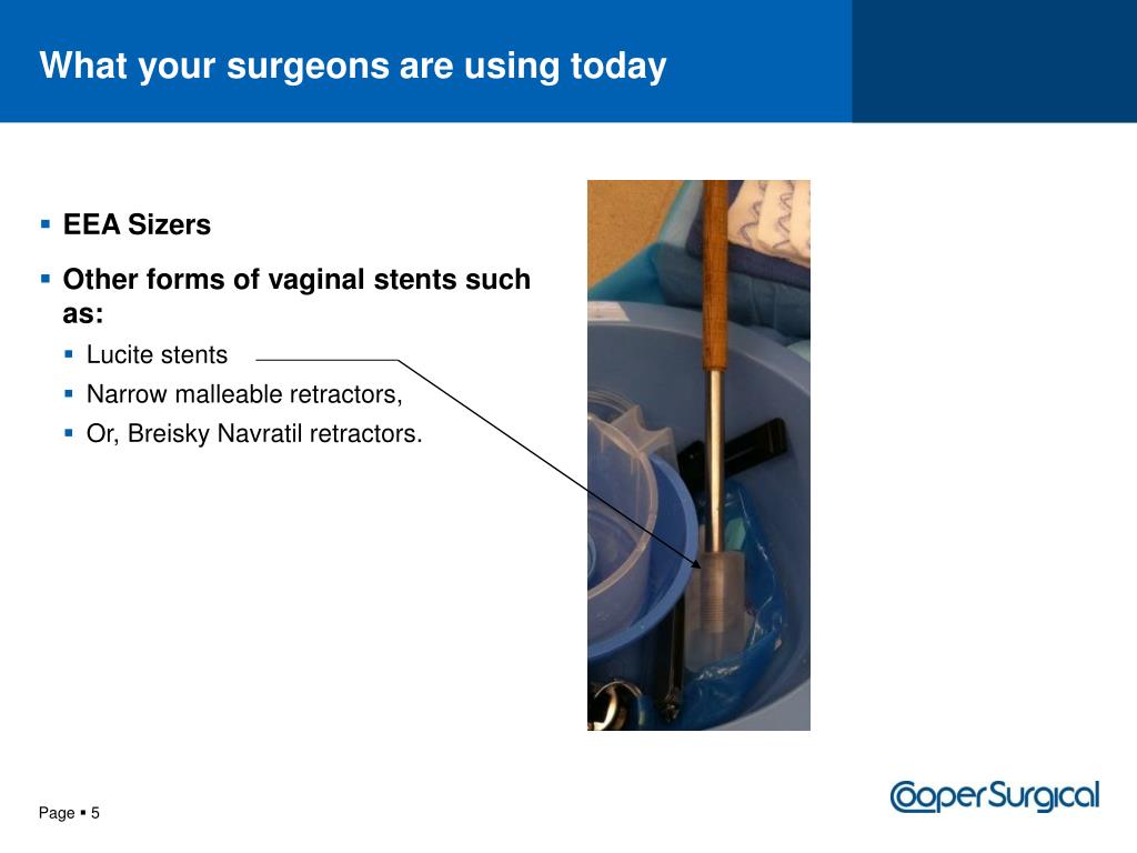 Ppt Sacrocolpopexy Understanding The Procedure Powerpoint