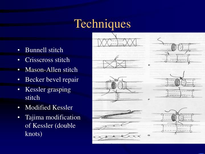 PPT - FLEXOR TENDON INJURIES James M. Steinberg D.O. Garden City ...
