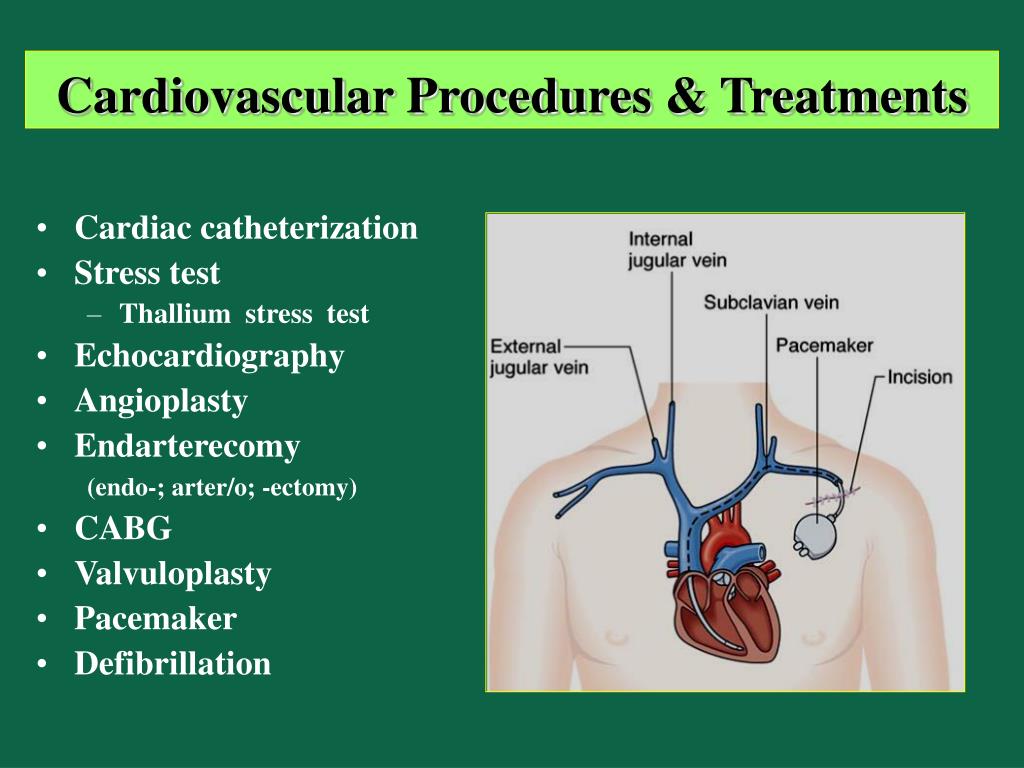 PPT - The Cardiovascular System Heart-------Blood Vessels------Blood ...