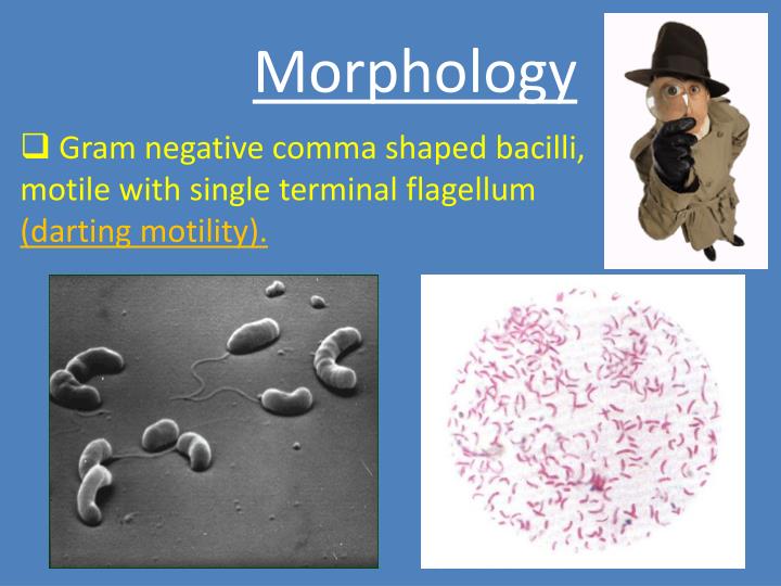 PPT - VIBRIOS PowerPoint Presentation - ID:1774390