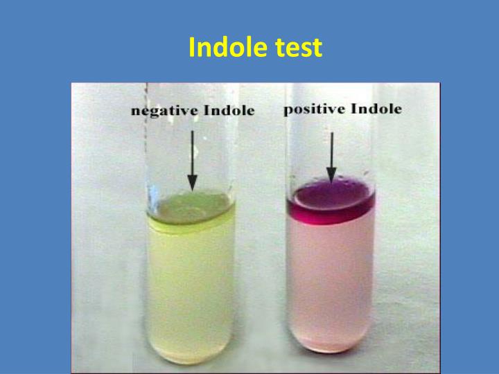 PPT - VIBRIOS PowerPoint Presentation - ID:1774390