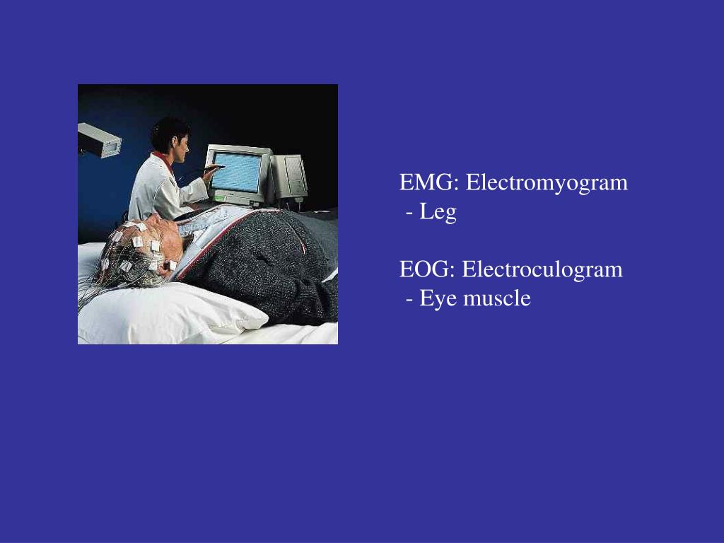 PPT - SLEEP Circadian Humans spend 1/3 of life sleeping (well over ...