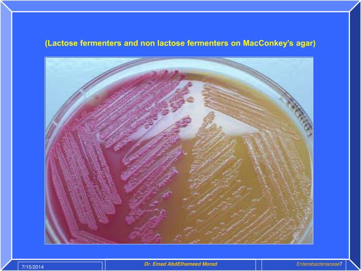 PPT - ENTEROBACTERIACEAE PowerPoint Presentation - ID:1776406