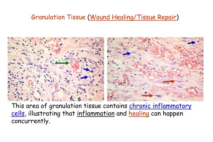 PPT - Wound Healing and Tissue Repair Friday, January 31, 2003 ...
