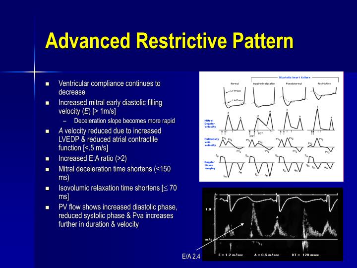 PPT - Restrictive Cardiomyopathy PowerPoint Presentation - ID:1778054